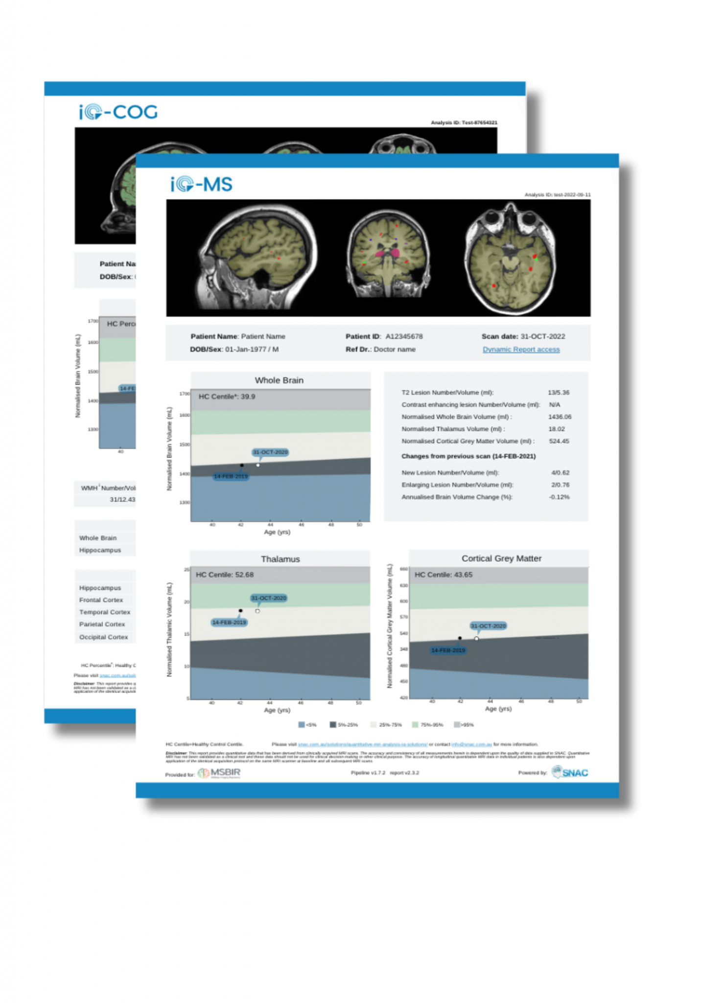 Quantitative MRI analysis / iQ-solutions™ | SNAC