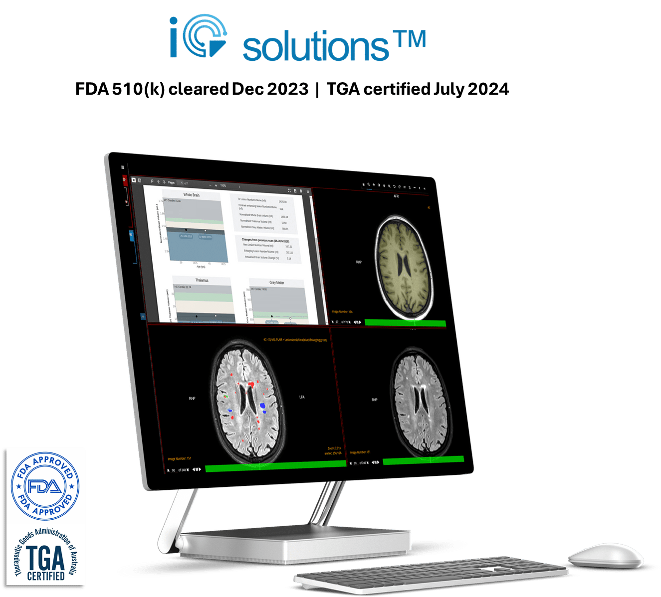 Quantitative MRI analysis / iQ-solutions™ | SNAC